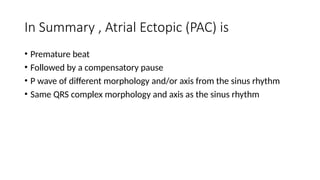 artrial and ventricular ectopic ecg teaching | PPTX