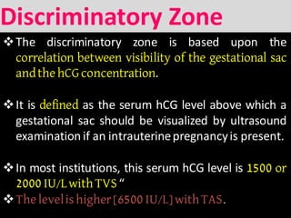 Ectopic Pregnancy | PPT