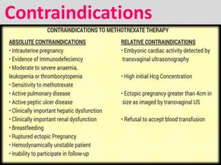 Ectopic Pregnancy | PDF