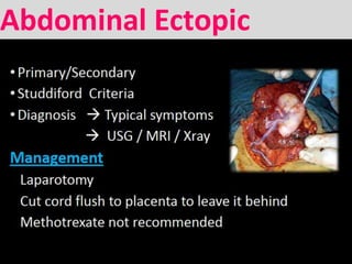 Ectopic Pregnancy | PPT