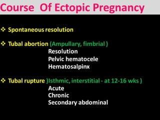 Ectopic Pregnancy | PPT