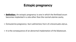 Ectopic-pregnancy, it's diagnosis, treatment and management | PPT