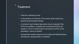Ectopic Beats | PPTX