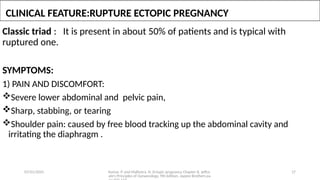 Ectopic pregnancy its types and management c9mplicationa | PPTX