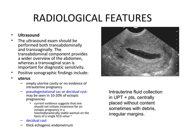 Ectopic gestation | PPT