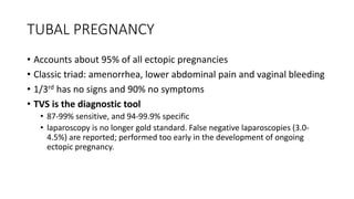 ECTOPIC PREGNANCY | PPTX