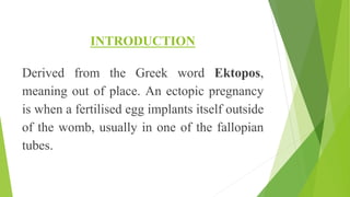ECTOPIC PREGNANCY ppt | PPTX