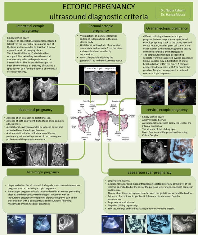 Ectopic p puster | PDF