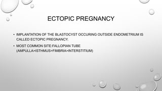 ectopic M. M. preg.pptx