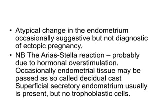 ECTOPIC PREGNANCY-1.ppt