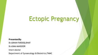 Ectopic Pregnancy-1.pptx
