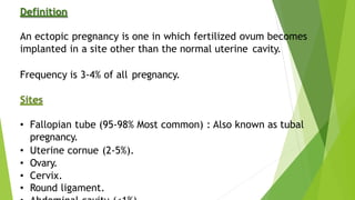 Ectopic Pregnancy-1.pptx