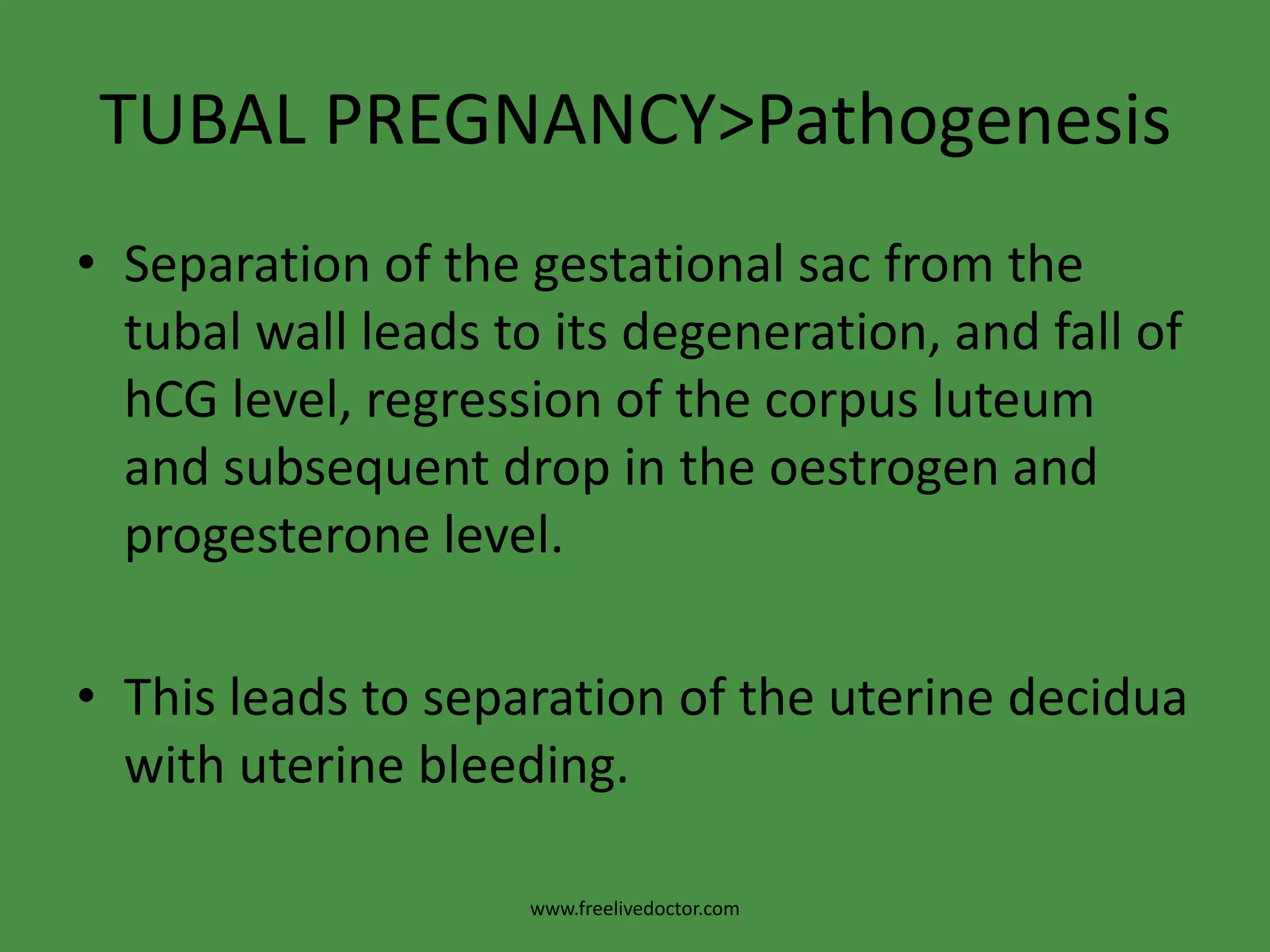 Ectopic pregnancy | PPTX