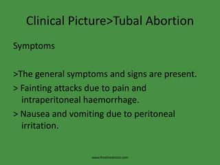Ectopic pregnancy | PPTX