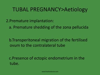 Ectopic pregnancy | PPTX