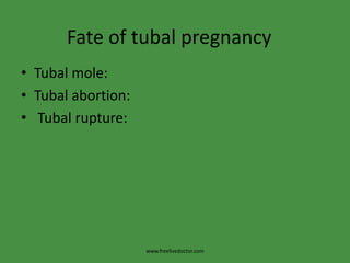 Ectopic pregnancy | PPTX