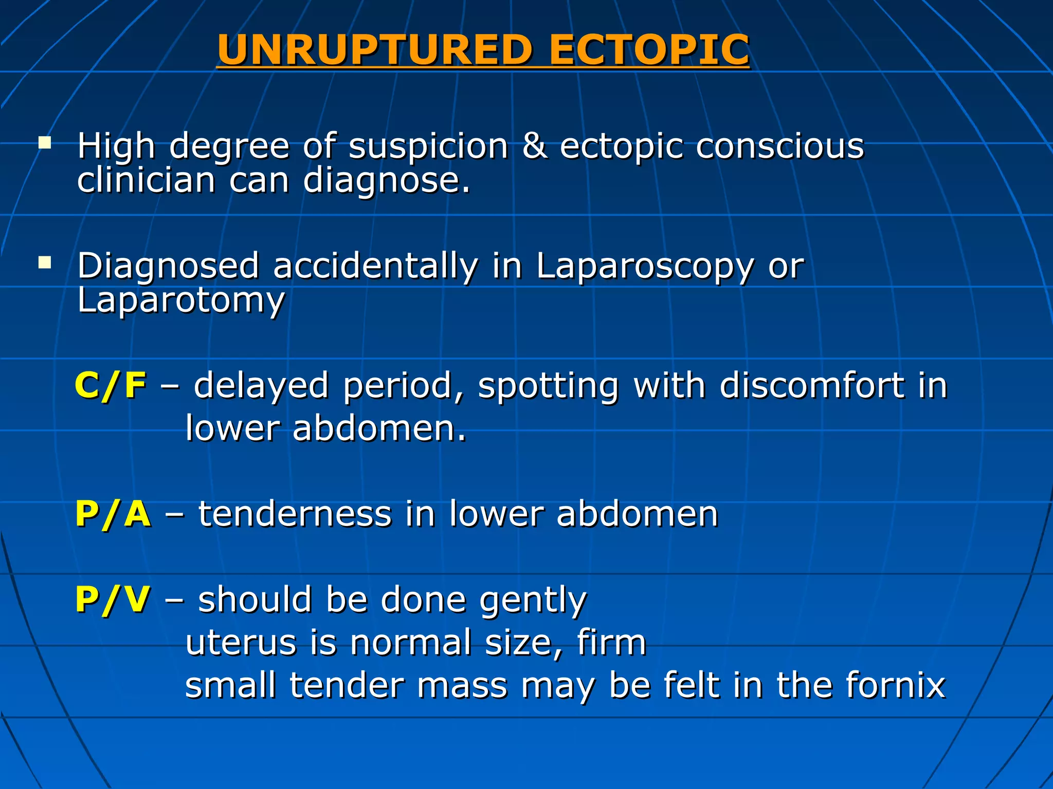 Ectopic pregnancy | PPT