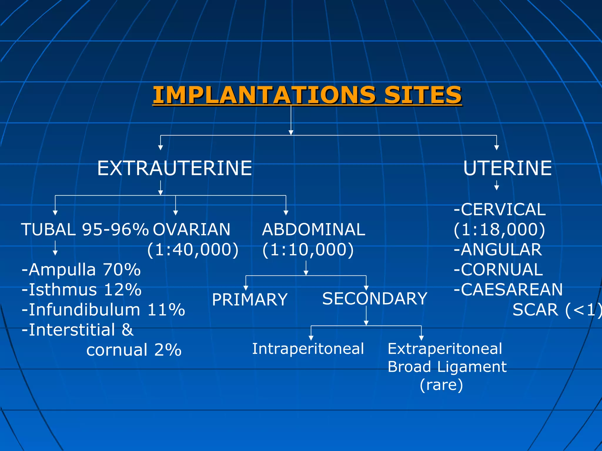 Ectopic pregnancy | PPT