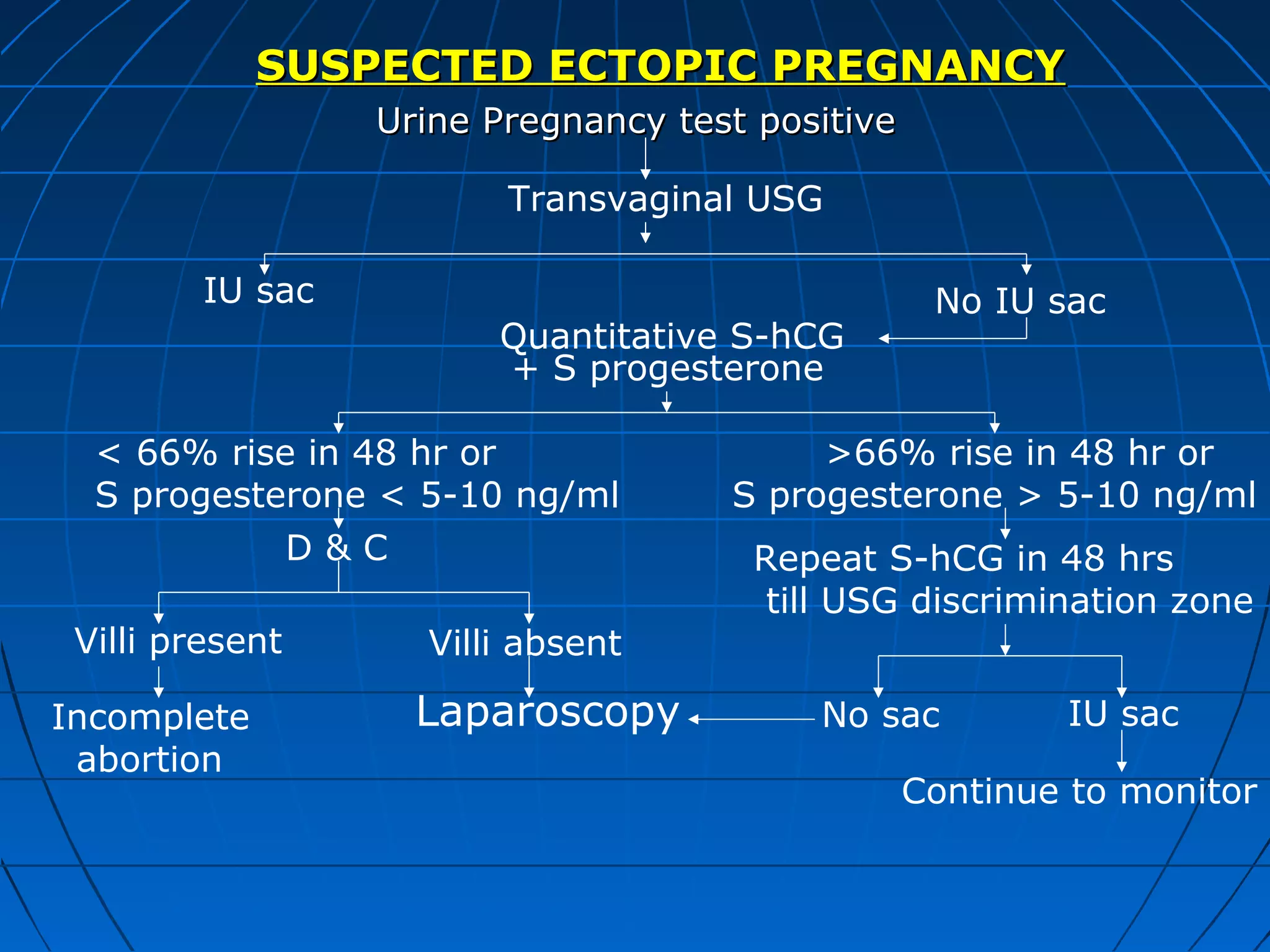 Ectopic pregnancy | PPT