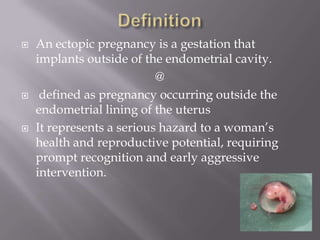 Ectopic pregnancy | PPT