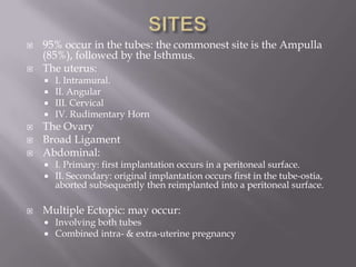 Ectopic pregnancy | PPTX