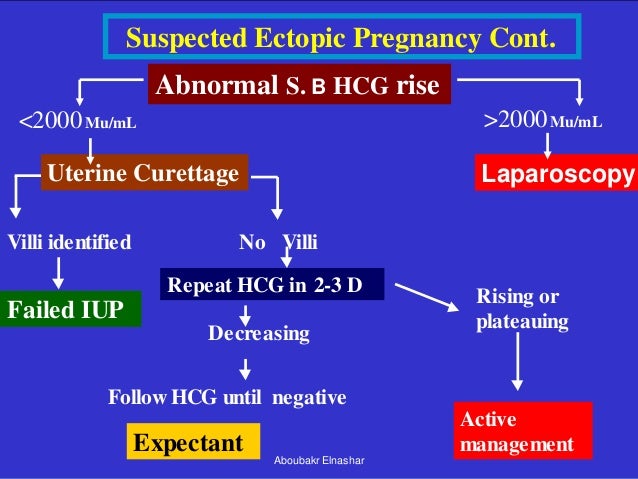 Ectopic Pregnancy ectopic-pregnancy