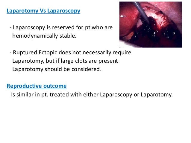 Laparotomy Vs Laparoscopy Laparotomy Vs Laparoscopy