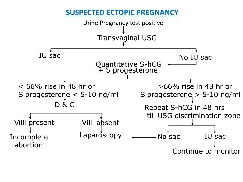 Ectopic Pregnancy ectopic-pregnancy