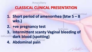 Ectopic pregnancy | PPTX