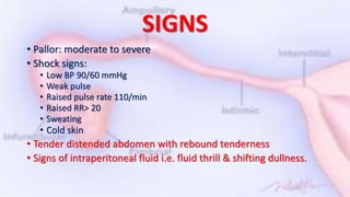 Ectopic pregnancy | PPTX