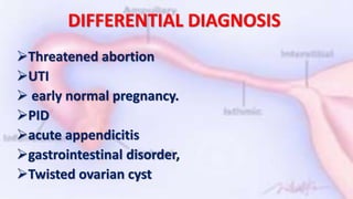 Ectopic pregnancy | PPTX