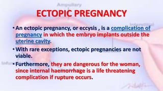 Ectopic pregnancy | PPTX