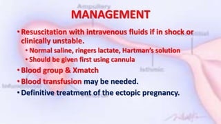 Ectopic pregnancy | PPTX