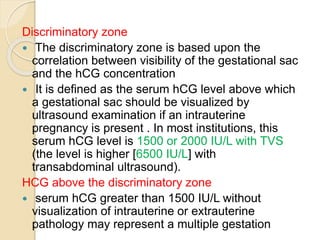 Ectopic pregnancy | PPTX