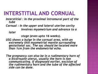 Ectopic pregnancy | PDF