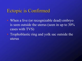 Ectopic pregnancy | PPTX