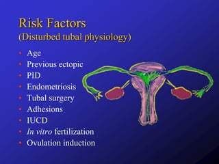 Ectopic pregnancy | PPTX