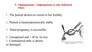 Ectopic pregnancy | PPTX