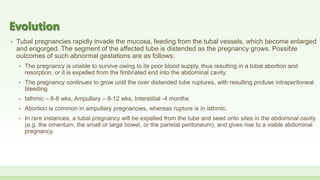 Ectopic pregnancy | PPTX