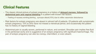 Ectopic pregnancy | PPTX