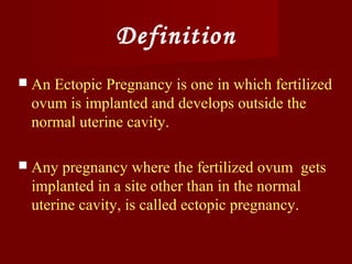 Ectopic pregnancy | PPT