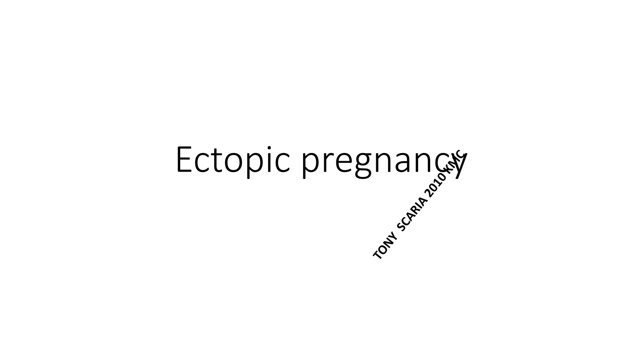 Ectopic pregnancy revision notes | PPT