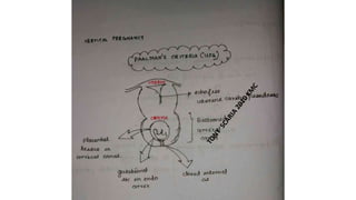 Ectopic pregnancy revision notes | PPT