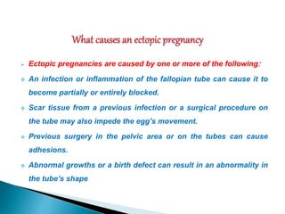 Ectopic pregnancy BY DR. USHA ARYA ( MBBS, MS - GYNAECOLOGIST) FATIMA ...