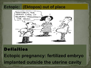 Ectopic pregnancy | PPT
