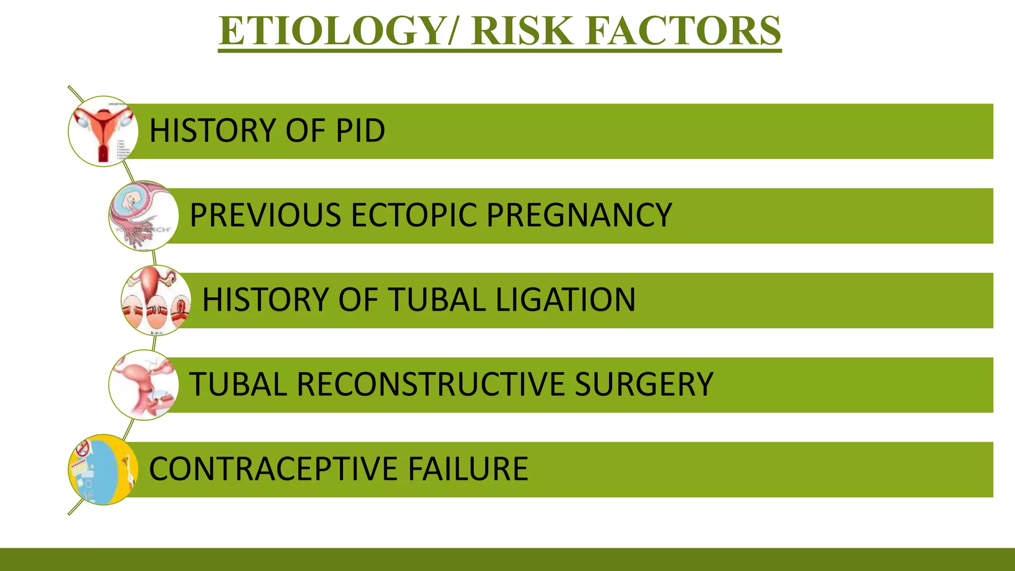 Ectopic pregnancy | PPTX