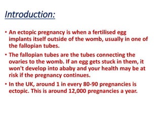 Ectopic pregnancy | PPTX