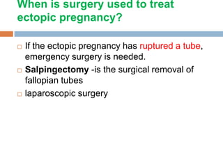 Ectopic pregnancy | PPTX