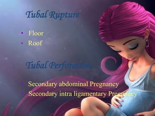 Ectopic pregnancy- Define, Type, Etiology, Sign and Symptoms, Treatment ...