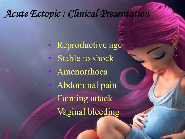 Ectopic Pregnancy Define Type Etiology Sign And Symptoms Treatment